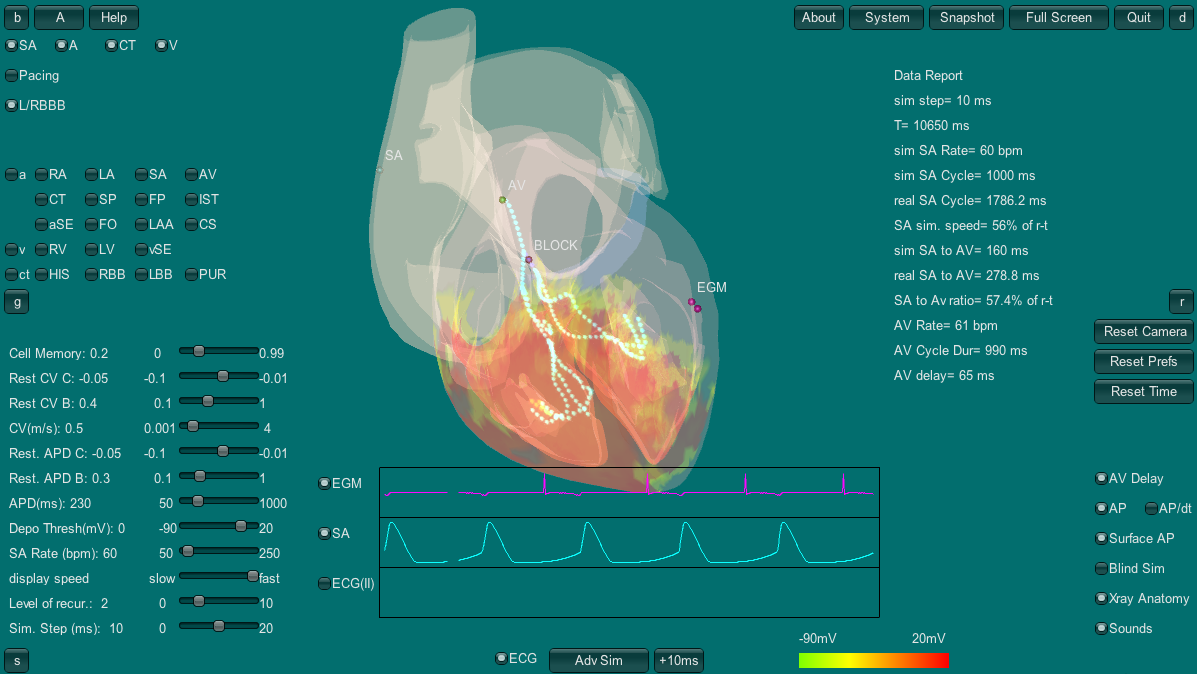 Epicardio Simulation™ - Research and development