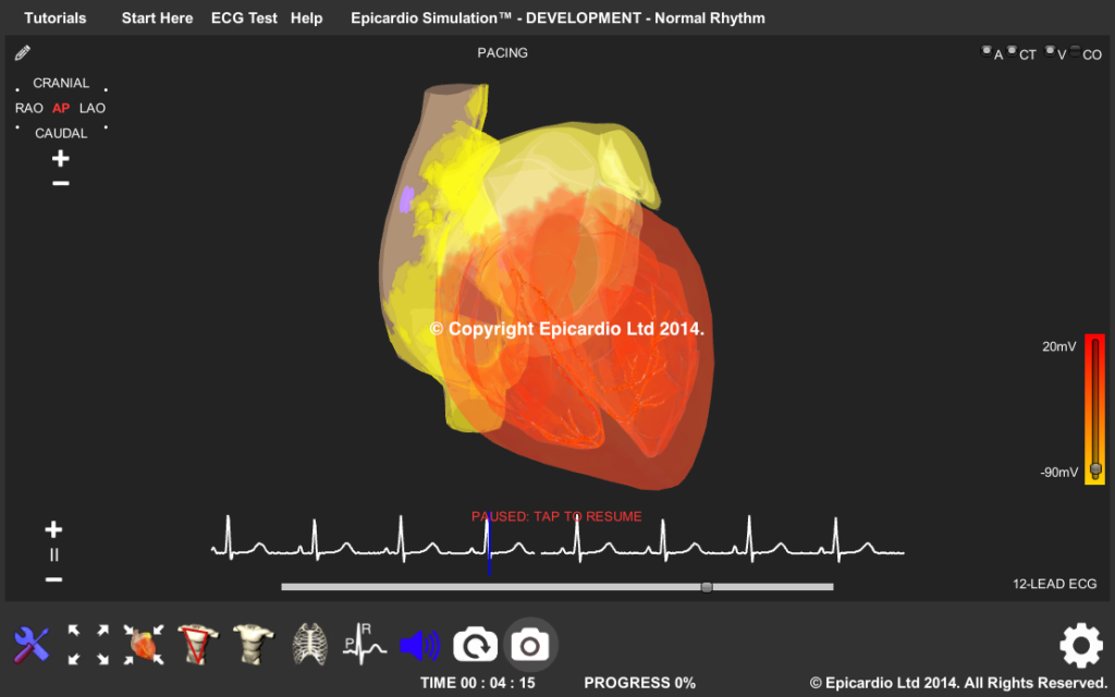 Epicardio Simulation™ - Research and development