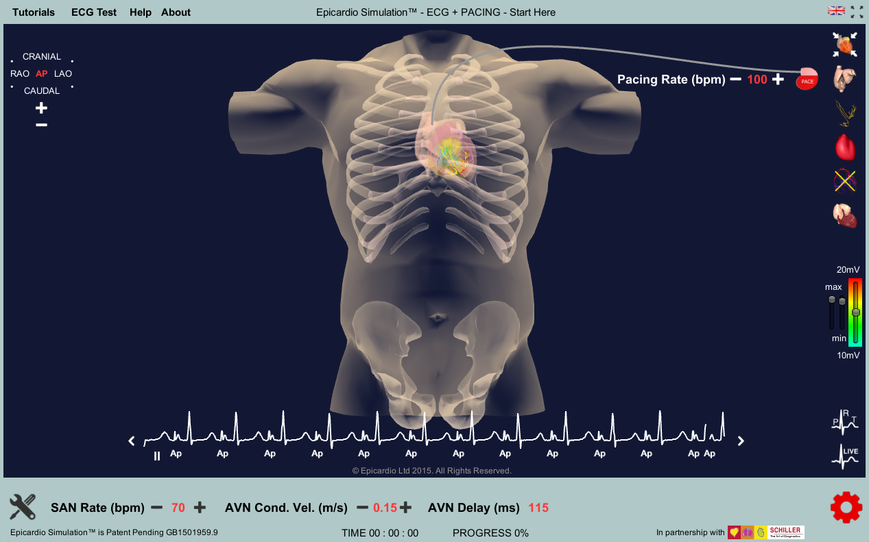 Epicardio Simulation™ - Research and development