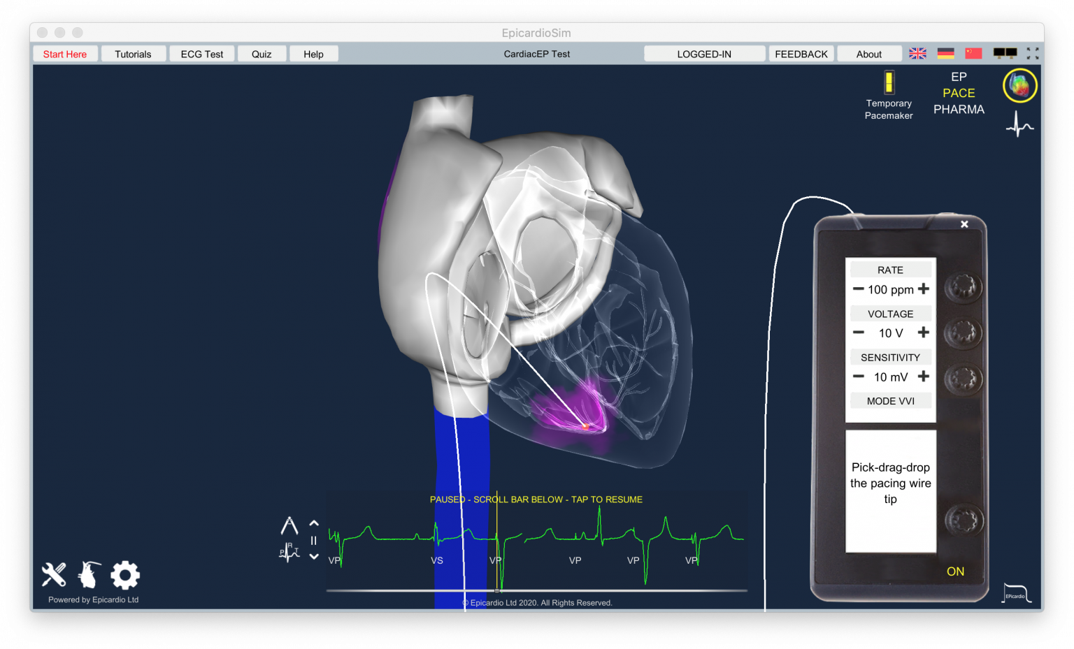 Epicardio Simulation™ - ECG e-training for medical schools