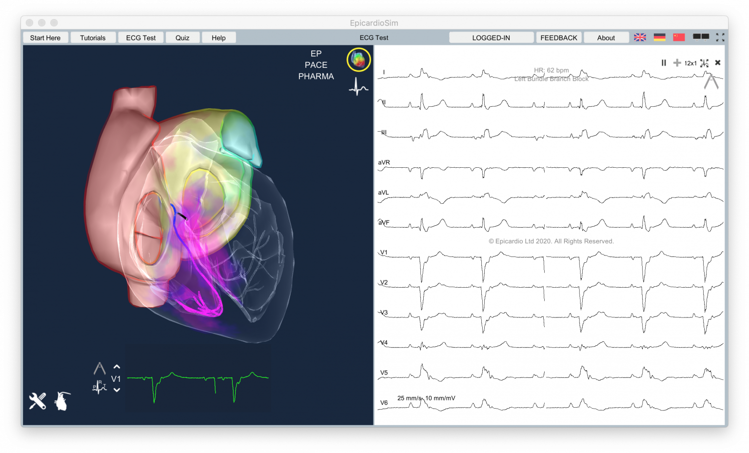 Epicardio Simulation™ - ECG e-learning for students