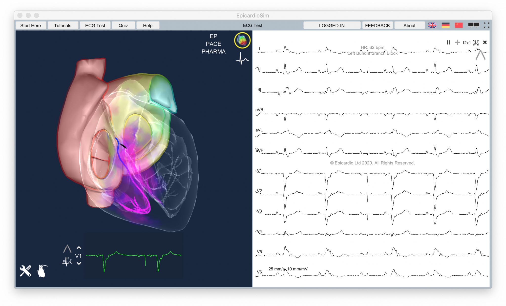 Epicardio Simulation™ - ECG e-learning for students