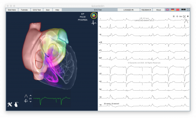 Epicardio Simulation™ - ECG e-learning for students