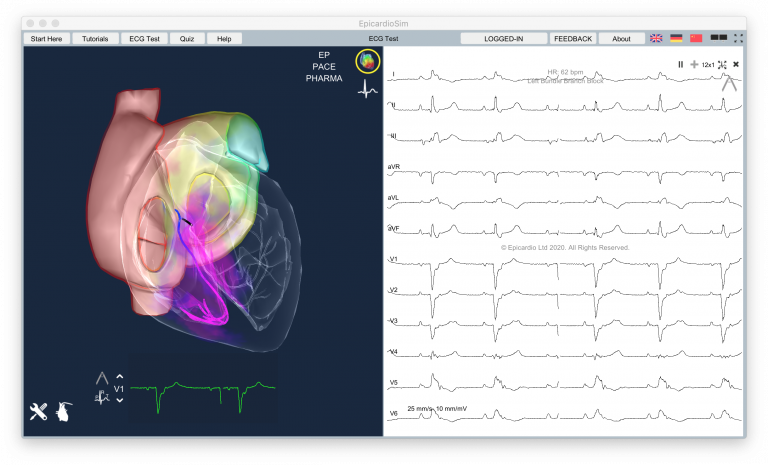 Epicardio Simulation™ - ECG e-learning for students
