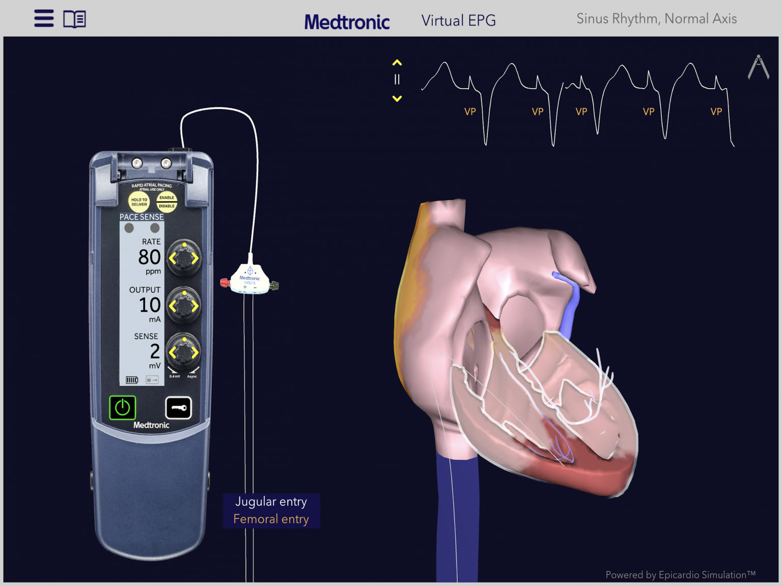 Epicardio on the Medtronic Academy