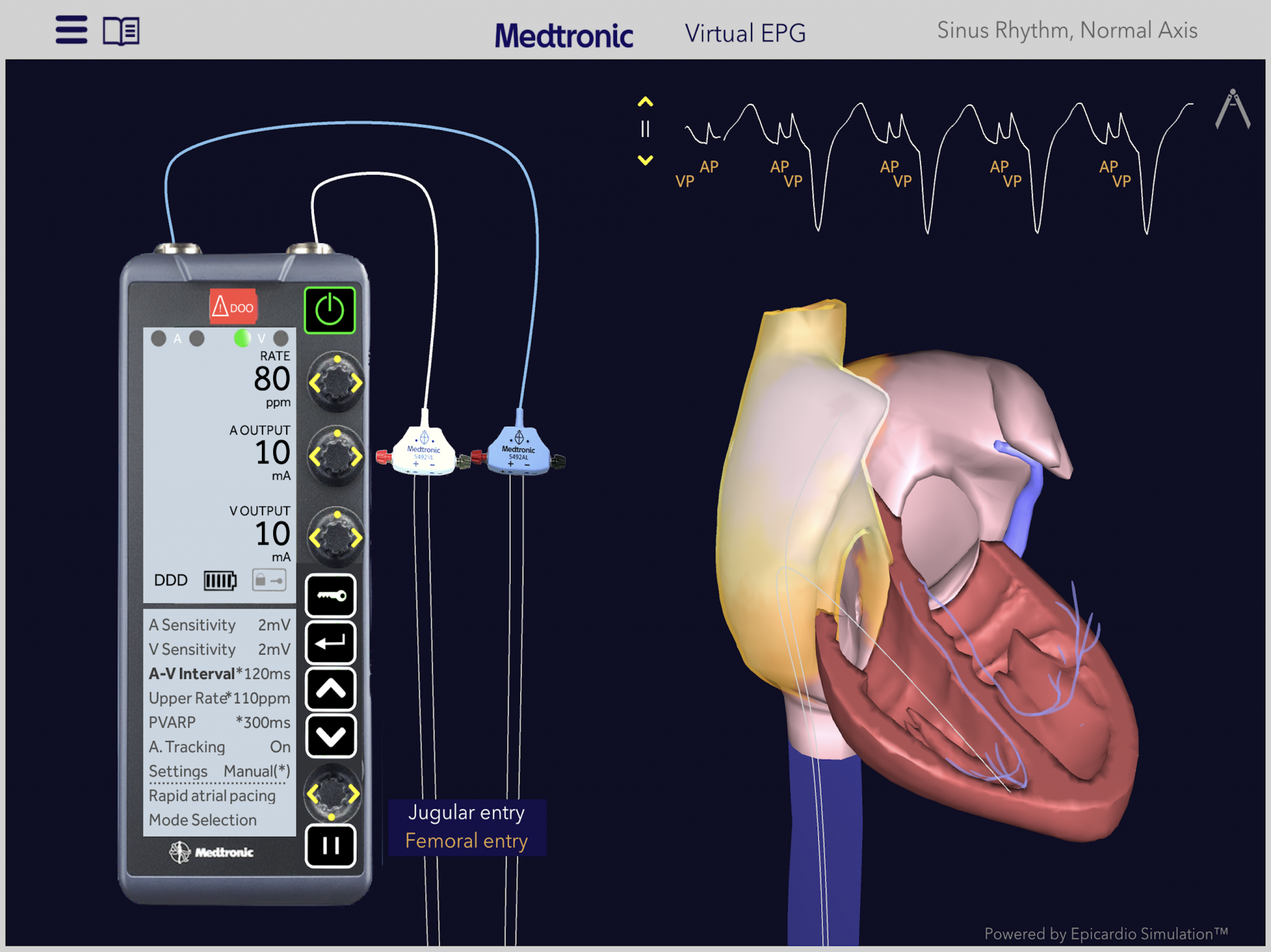 Epicardio on the Medtronic Academy