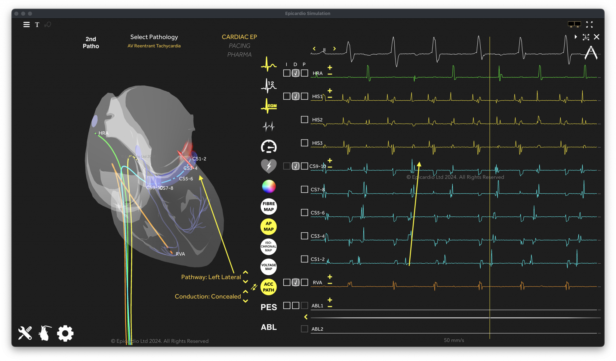 Epicardio Simulation™ - ECG e-training for medical schools