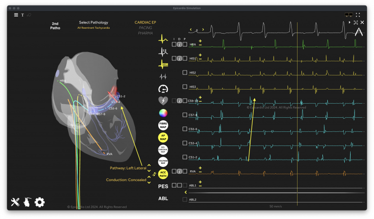 Epicardio Simulation™ - ECG e-training for medical schools